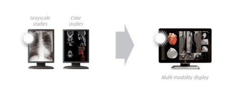 What is a radiology monitor? - Barco