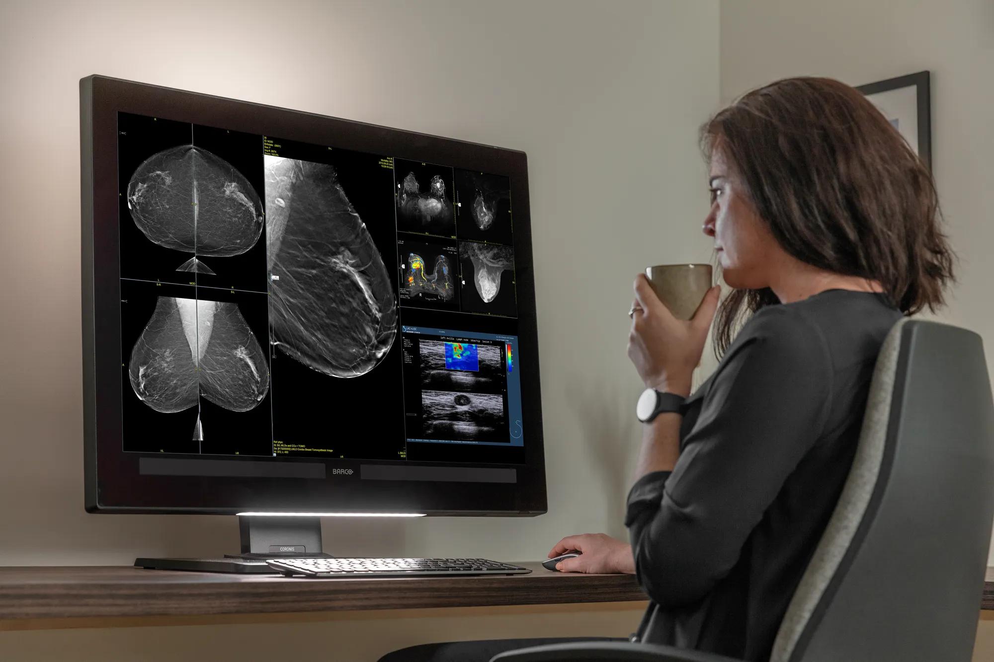 Telework in breast radiology - Barco