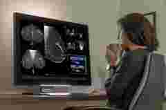 5 display hurdles in mammography - and the solution - Barco