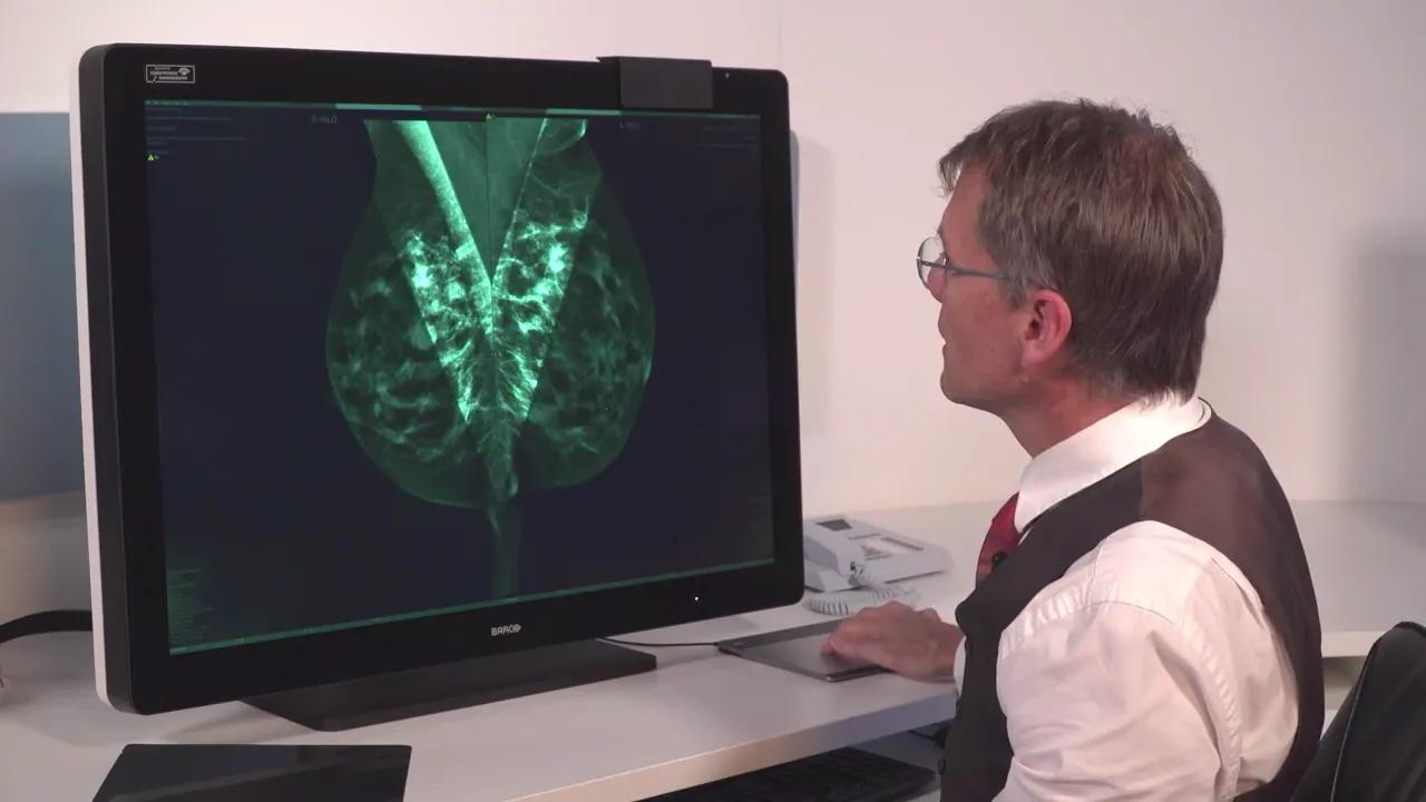 Methodical mammography screening - Barco