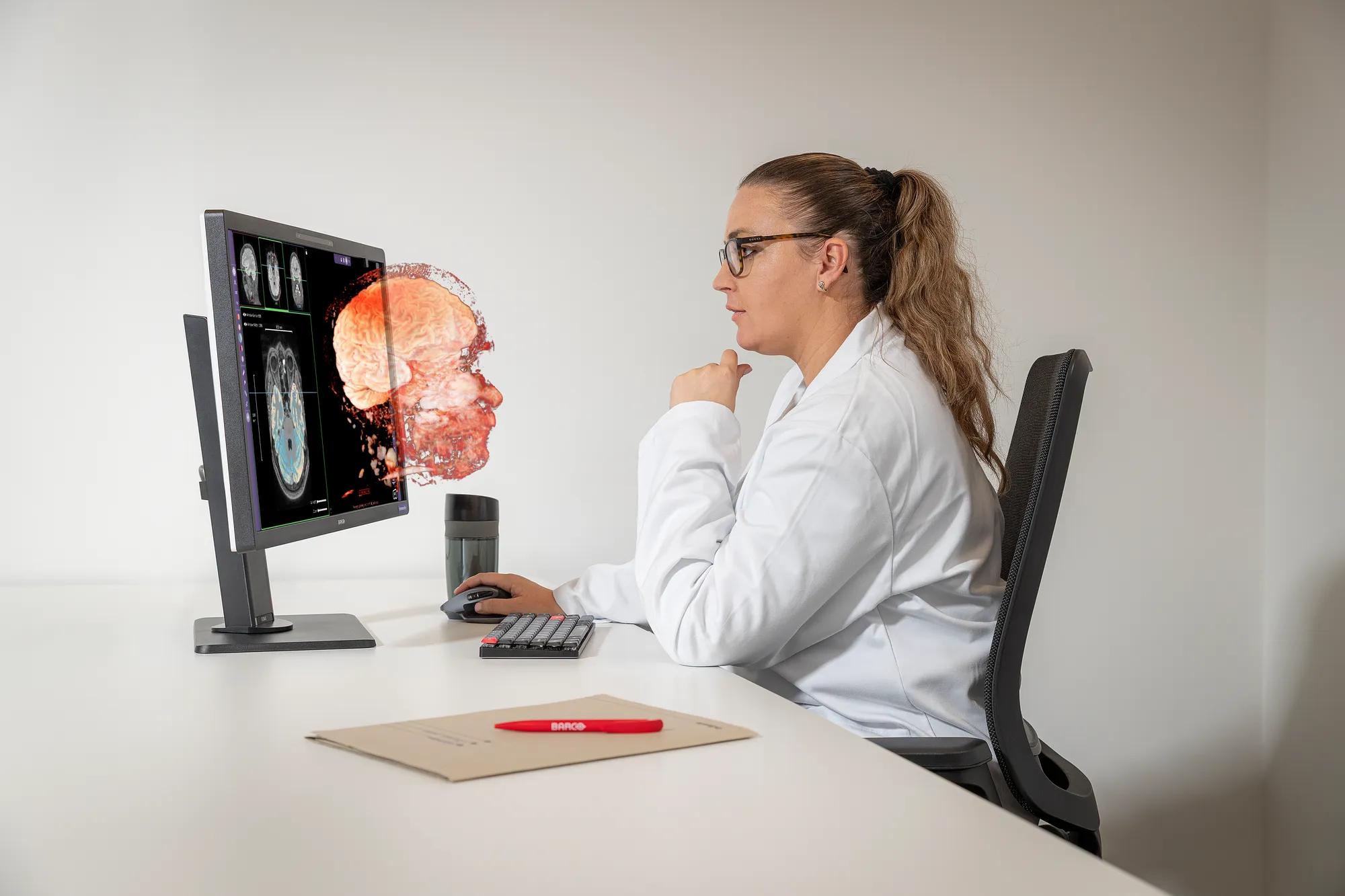 Barco launches Eonis 3D glasses-free 3D medical visualization solution ...