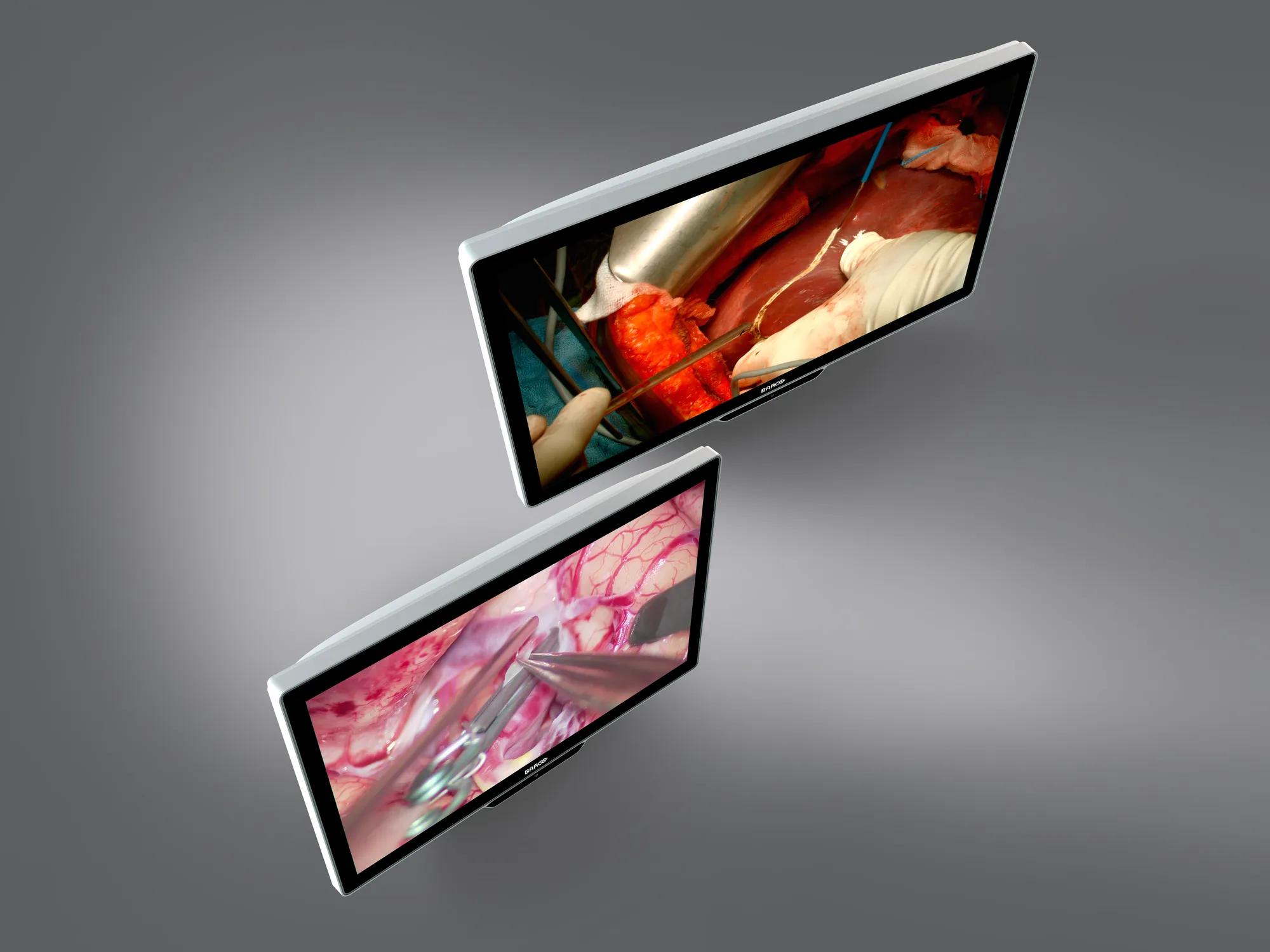 4K end-to-end solutions for the operating room - Barco