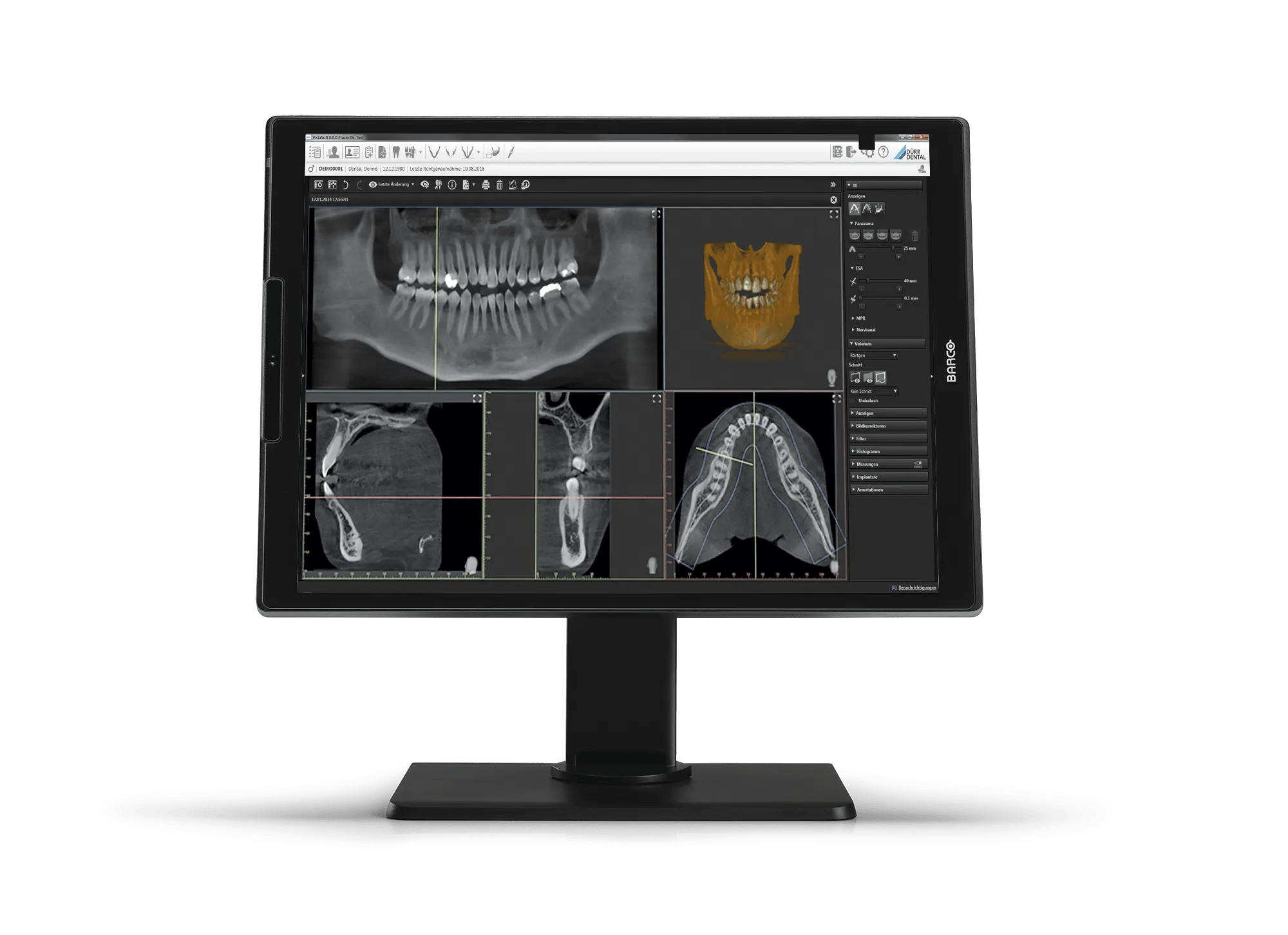 Nio Color 3MP Dental (MDNC-3521 Option DE) - Dental displays - Barco