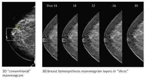 Breast imaging display - Barco