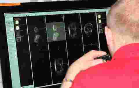 Barco medical displays enable accurate diagnoses at radprax - Barco