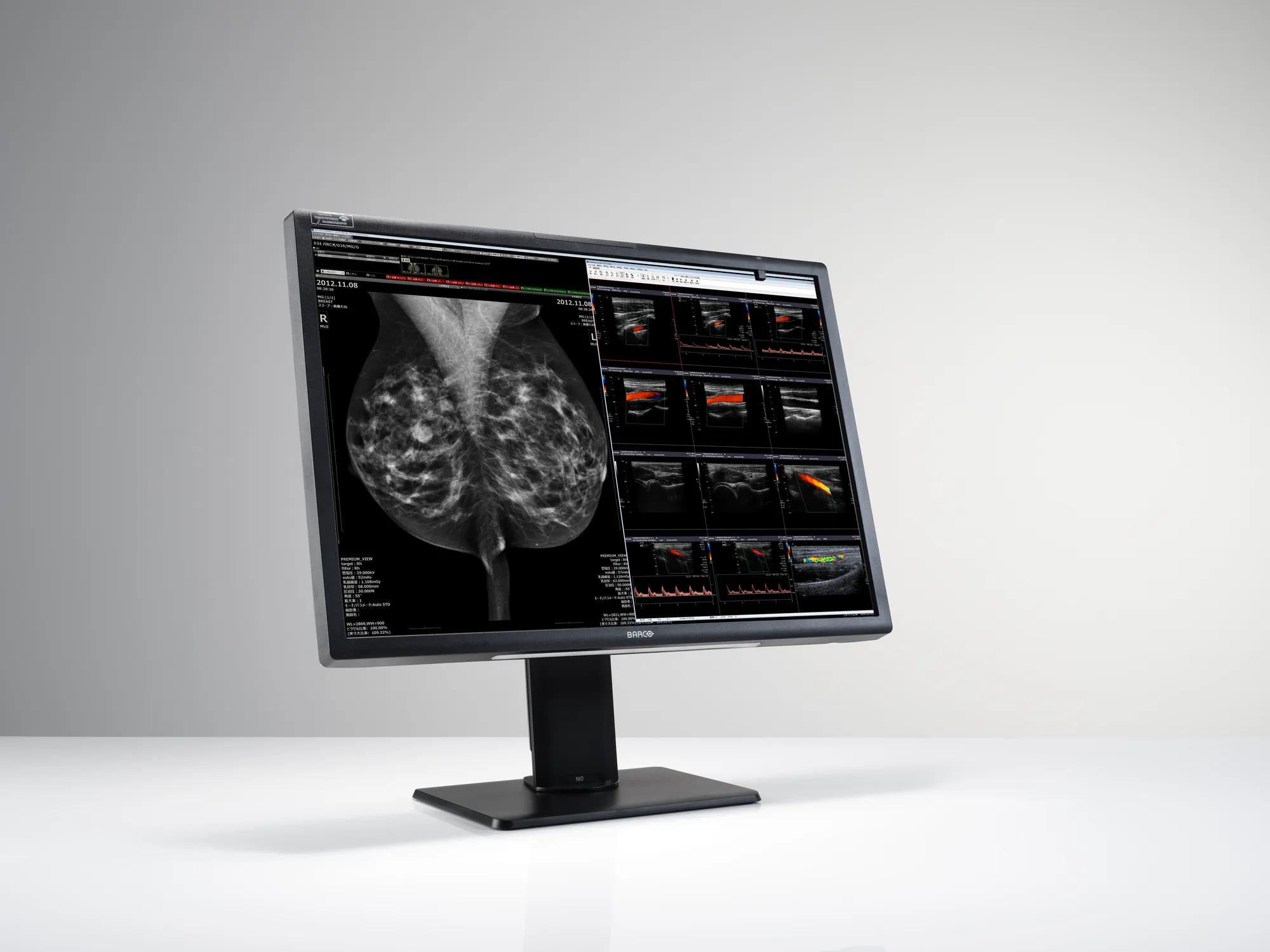 Nio Fusion 12MP (MDNC-12130) - Breast imaging displays - Barco