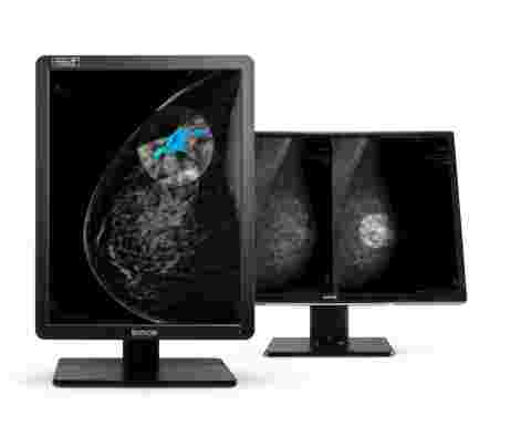 Barco announces introduction of AI technology for visualization of ...