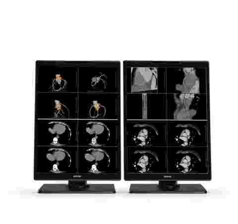 Redefining today’s standard of diagnostic imaging, with a new series of ...