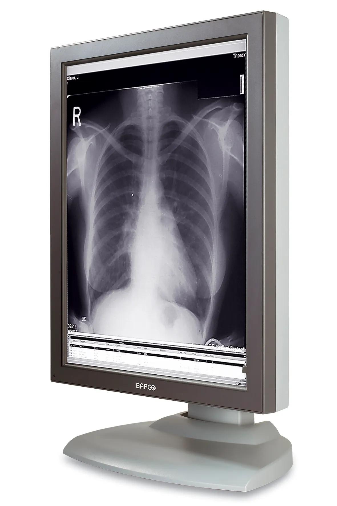 MFGD 3420 - Product support - Barco