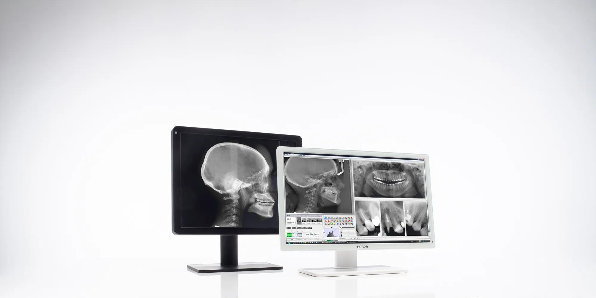 Dental monitors - Barco