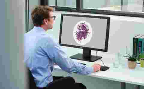 Digital pathology displays - Barco