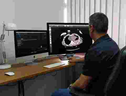 Radiology displays - Barco