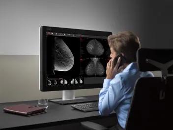 What are mammography monitors? - Barco