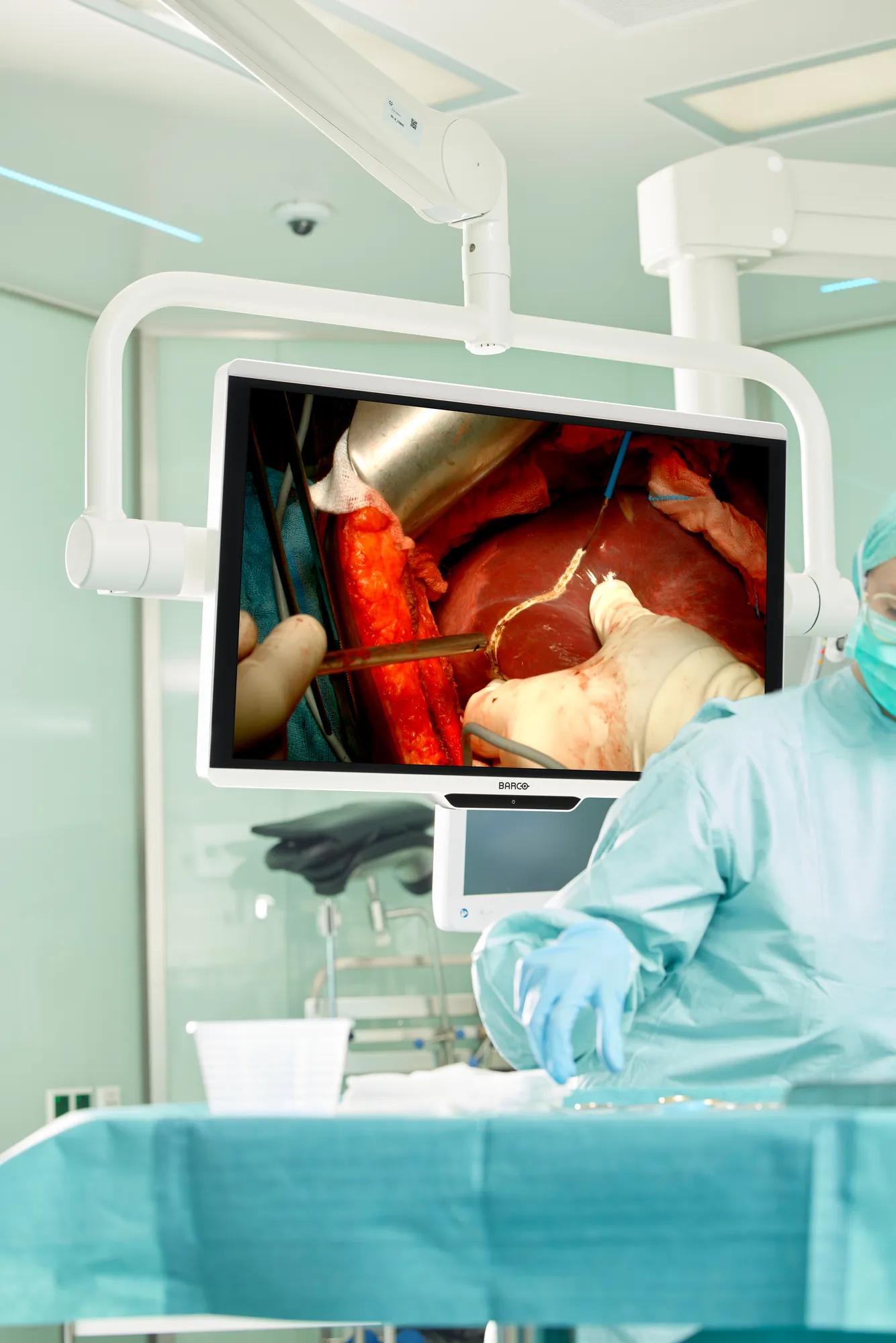 What are surgical monitors? - Barco