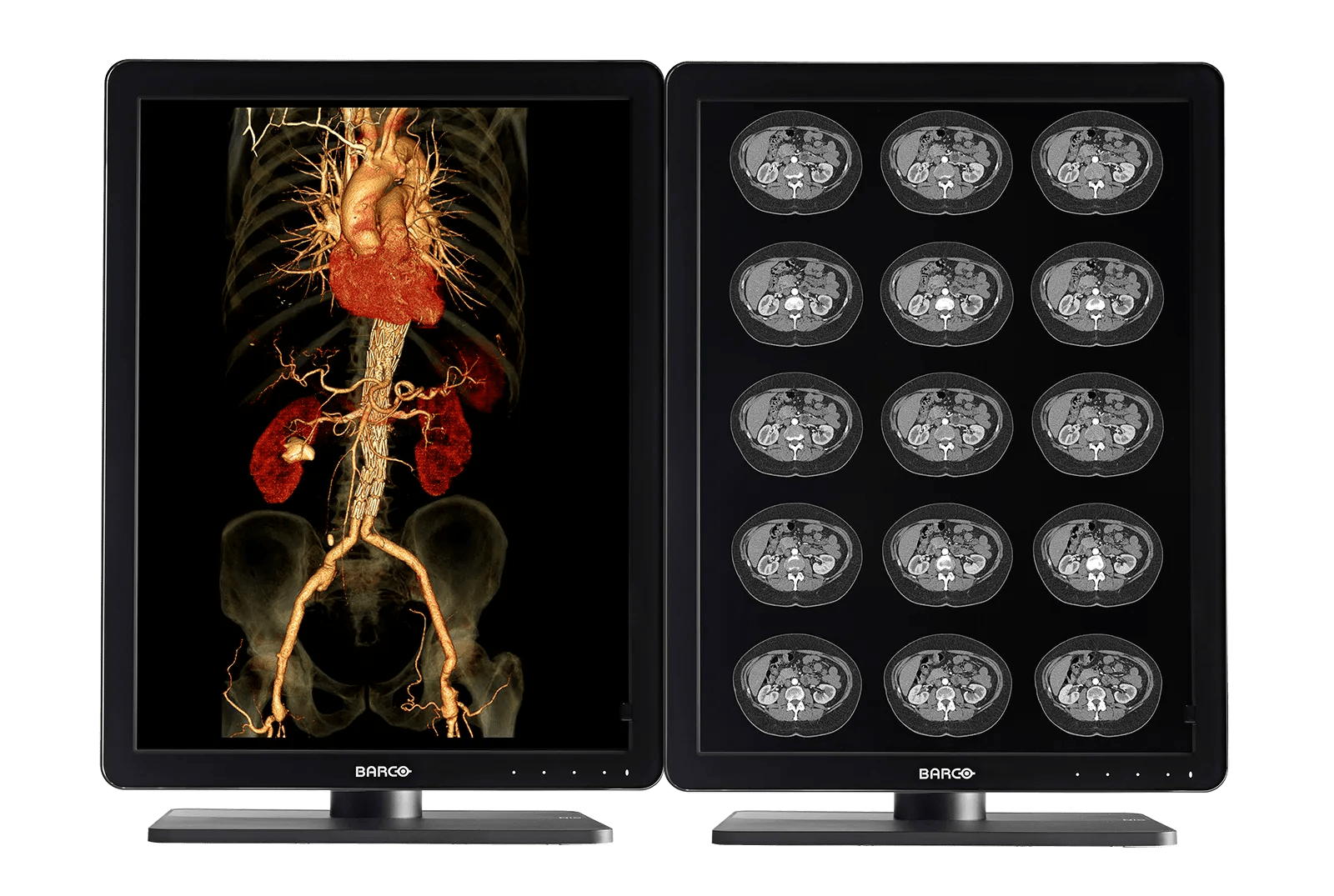 Nio Color 3MP (MDNC-3421CN) - Radiology displays - Barco
