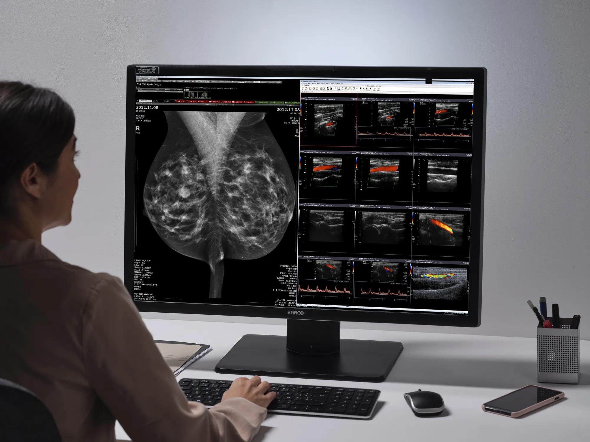 What is DICOM calibration? - Barco
