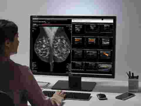 Breast imaging displays - Barco
