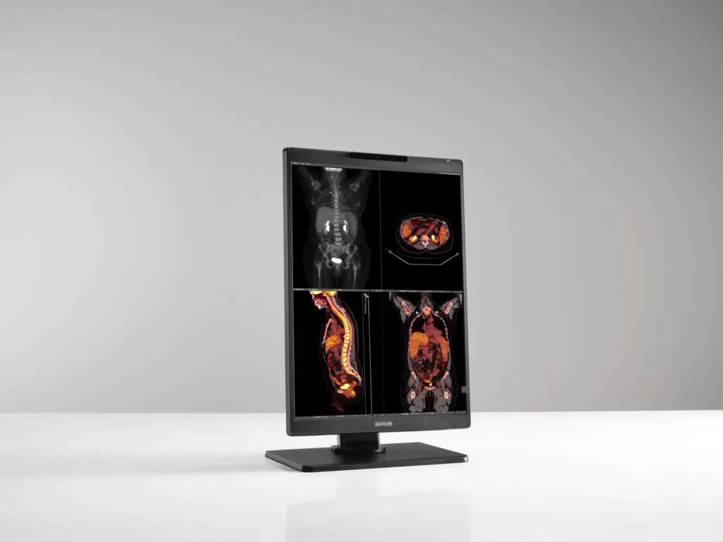 Nio Color 3MP (MDNC-3521) - Radiology displays - Barco